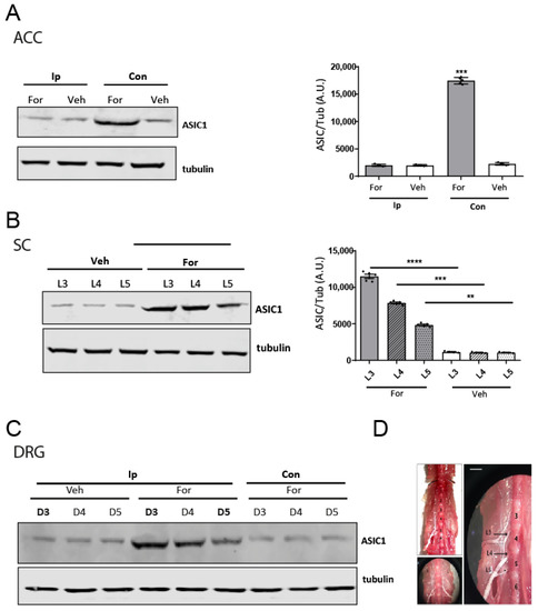 Segmental Upregulation of ASIC1 Channels in the Formalin Acute Pain ...