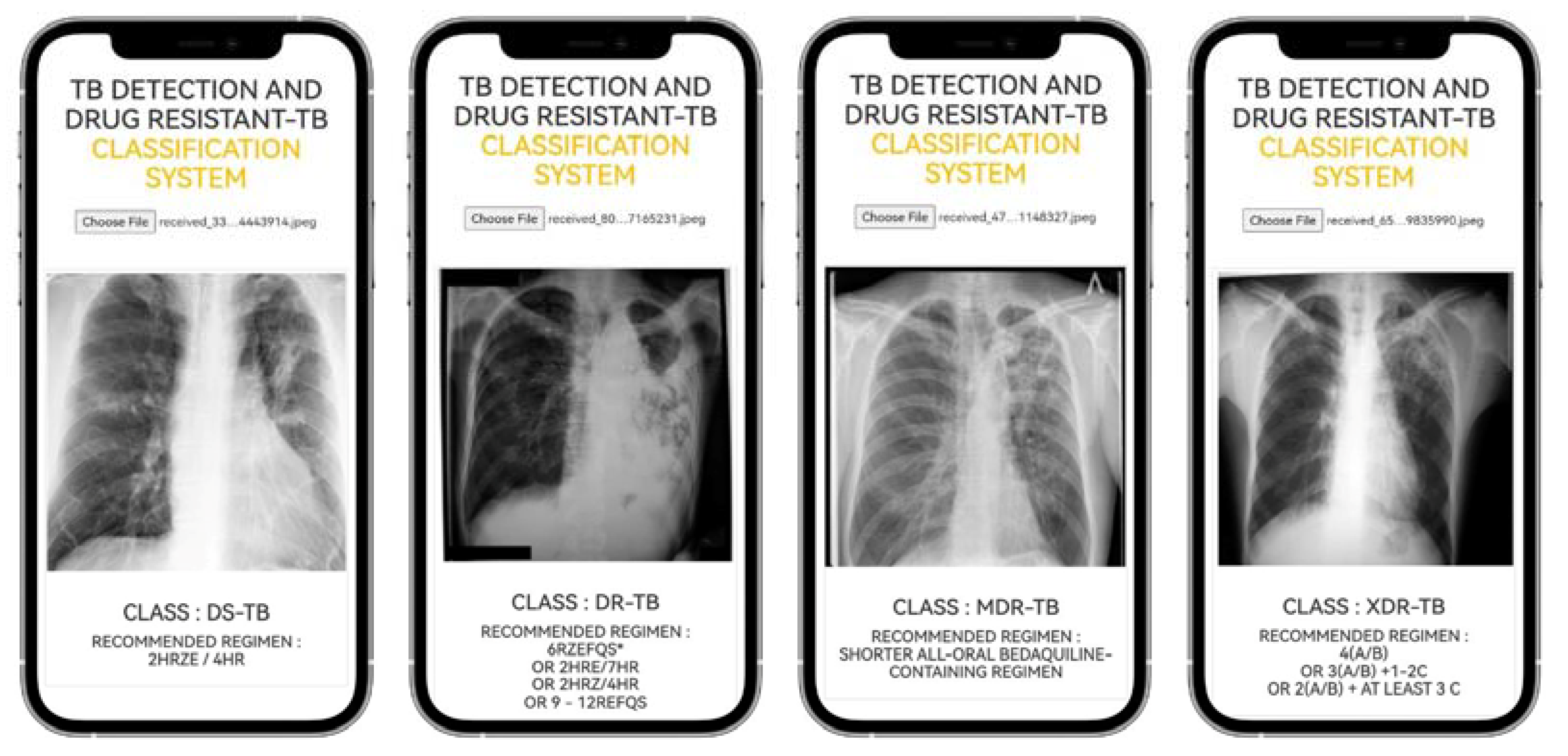 Drug-Resistant Tuberculosis Treatment Recommendation, and Multi-Class Tuberculosis Detection and ...