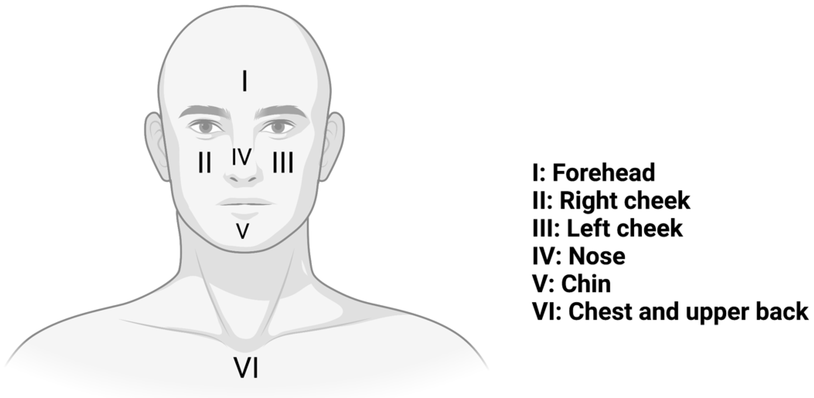Insulin Resistance and Acne: The Role of Metformin as Alternative ...