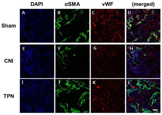 Established Immortalized Cavernous Endothelial Cells Improve Erectile ...