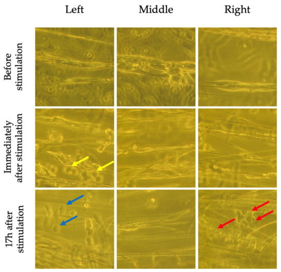 Fiber and Electrical Field Alignment Increases BDNF Expression in SH ...