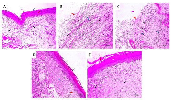 Fabrication of Celecoxib PVP Microparticles Stabilized by Gelucire 48/ ...