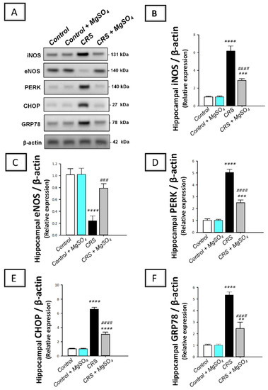 Targeting the Endoplasmic Reticulum Stress-Linked PERK/GRP78/CHOP ...