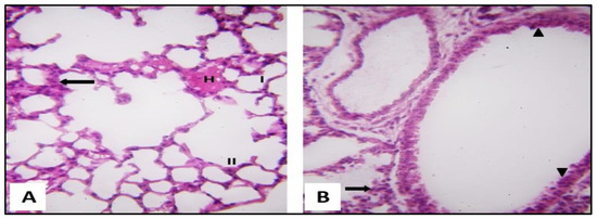 Protective Potential of Saussurea costus (Falc.) Lipsch. Roots against ...