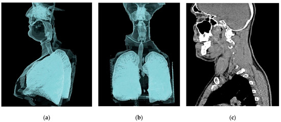 Numerical and Experimental Analysis of Drug Inhalation in Realistic ...