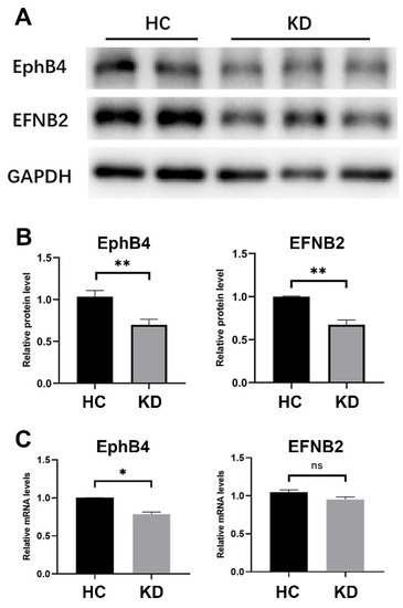 The Therapeutic Effects of EFNB2-Fc in a Cell Model of Kawasaki Disease