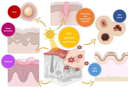 Nanogel Containing Gamma-Oryzanol-Loaded Nanostructured Lipid Carriers ...