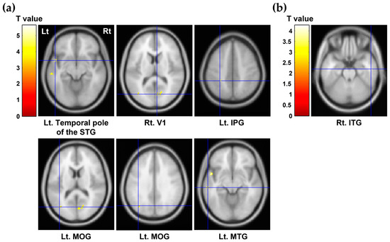 The Relationship between Character Traits and In Vivo Cerebral Serotonin Transporter ...