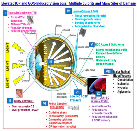Elevated Intraocular Pressure and Glaucomatous Optic Neuropathy: Genes ...