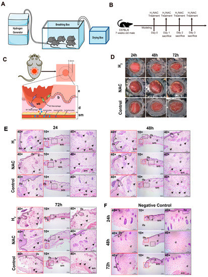 Hydrogen Attenuates Inflammation by Inducing Early M2 Macrophage ...