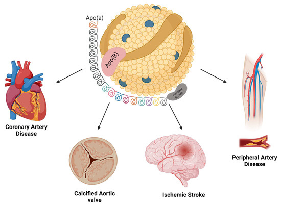 Current Management and Future Perspectives in the Treatment of Lp(a ...