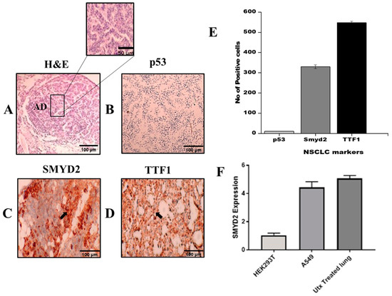 Dissecting the Role of SMYD2 and Its Inhibitor (LLY-507) in the ...