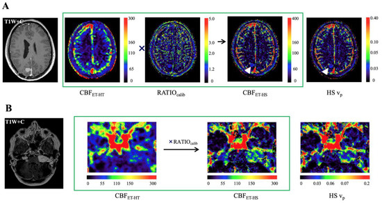 Pharmaceuticals | Free Full-Text | A Novel Multi-Model High Spatial ...