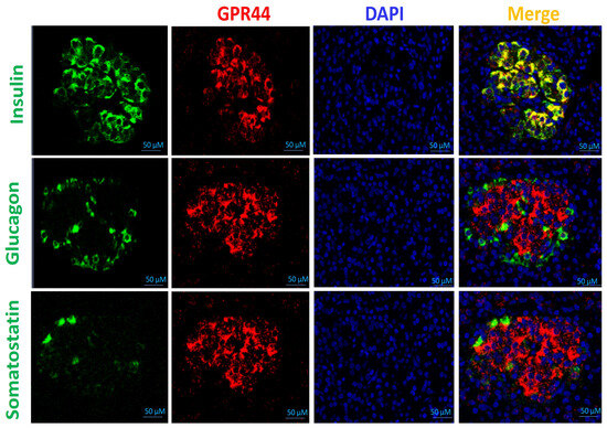 One-Step Automatic Radiosynthesis and Evaluation of [18F]TM-30089 as ...