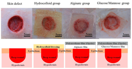 Wound Healing Performance in a Moist Environment of Crystalline Glucose ...