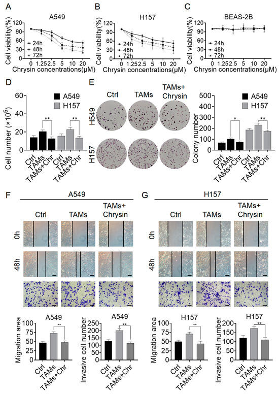 Chrysin Inhibits TAMs-Mediated Autophagy Activation via CDK1/ULK1 Pathway and Reverses TAMs ...
