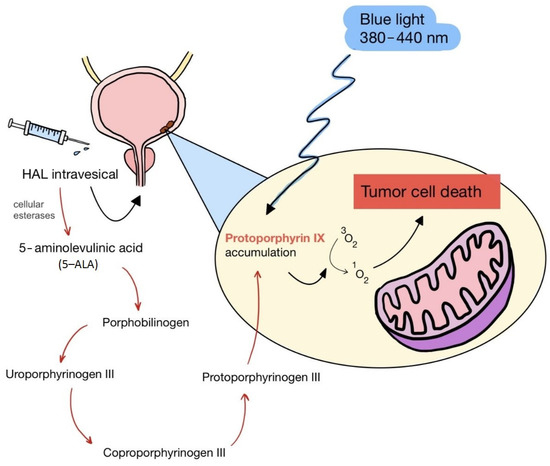 Photodynamic Therapy in the Treatment of Cancer—The Selection of ...