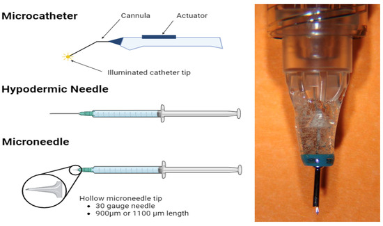 What’s New in Ocular Drug Delivery: Advances in Suprachoroidal ...