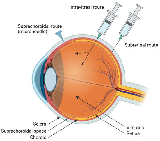 What’s New in Ocular Drug Delivery: Advances in Suprachoroidal ...