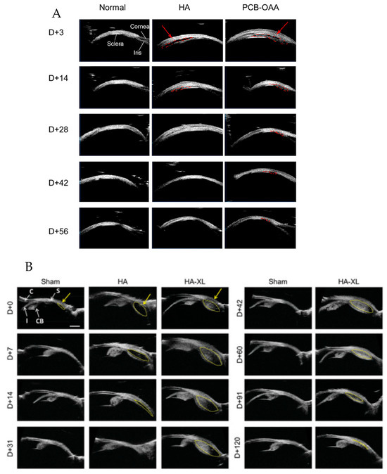 What’s New in Ocular Drug Delivery: Advances in Suprachoroidal ...