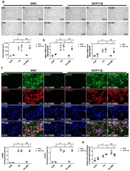 Intermedin Alleviates Diabetic Cardiomyopathy by Up-Regulating CPT-1β ...