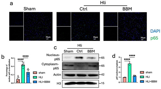 Berbamine Promotes the Repair of Lower Limb Muscle Damage in Chronic ...