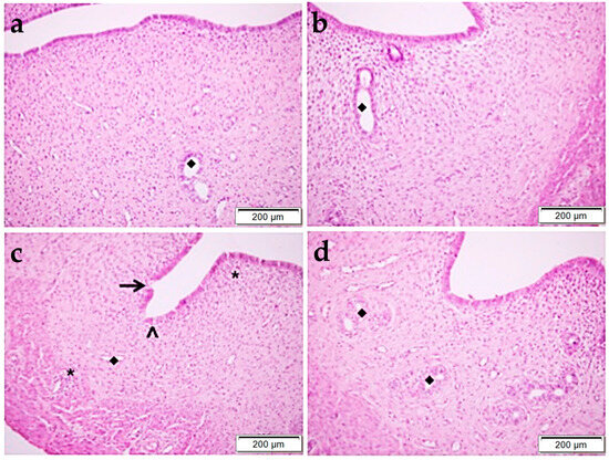 Boric Acid Protects the Uterus and Fallopian Tubes from ...