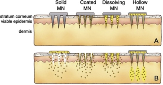 Pharmaceutics | Free Full-Text | Transdermal Delivery of Drugs with ...