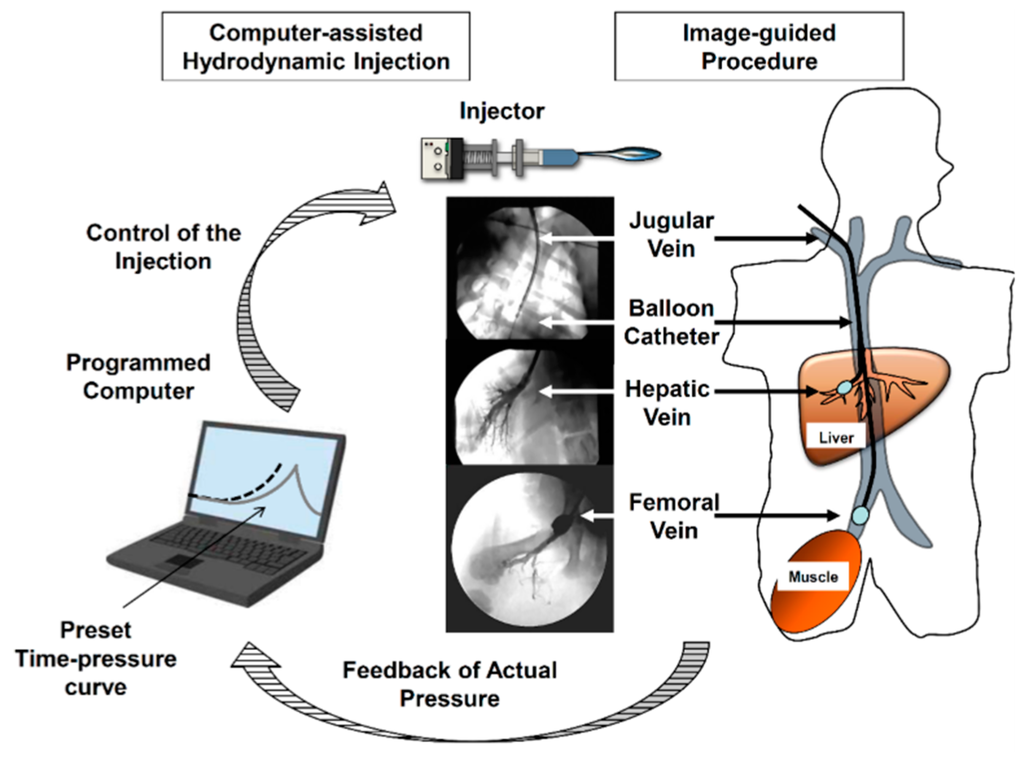 Image-Guided Hydrodynamic Gene Delivery: Current Status and Future ...