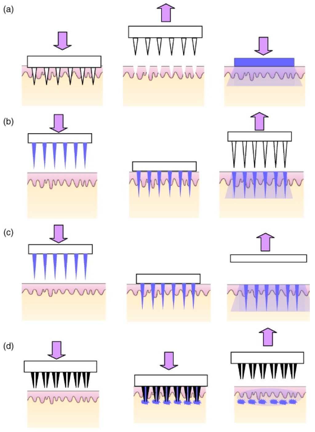 Pharmaceutics | Special Issue : Microneedle Patches: Developing ...