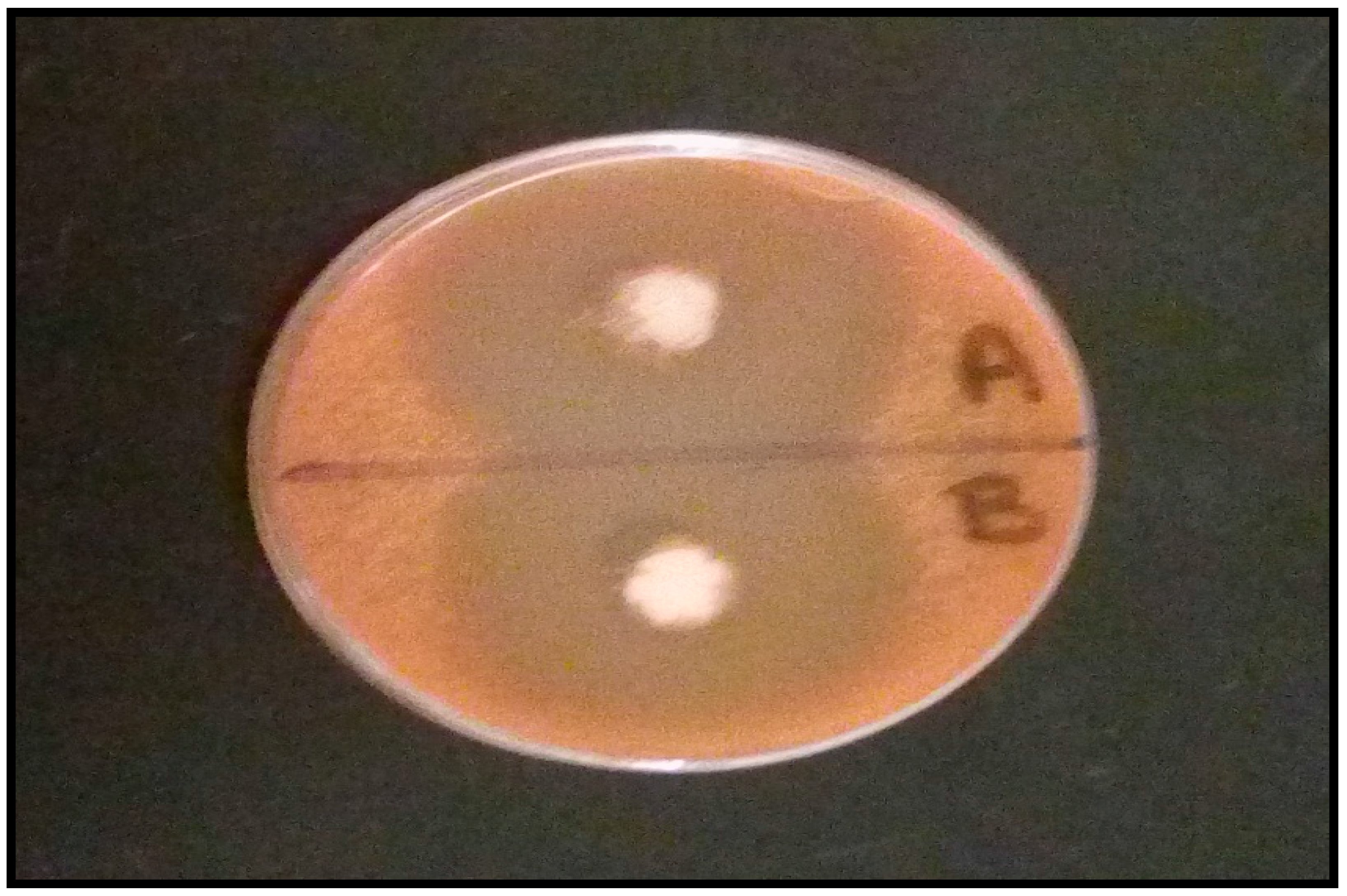 Design, Optimization and Characterization of a Transfersomal Gel Using ...