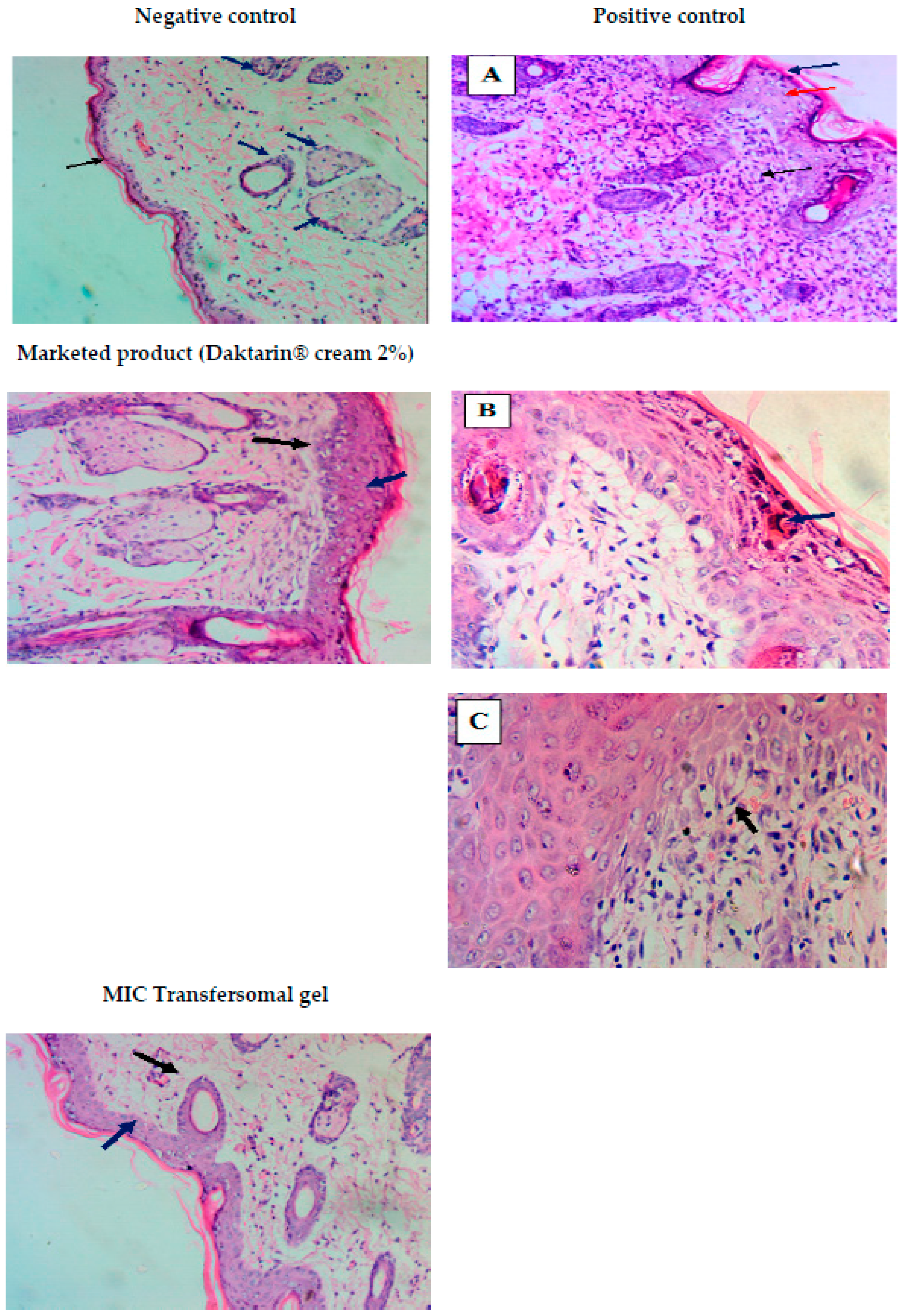 Design, Optimization and Characterization of a Transfersomal Gel Using ...