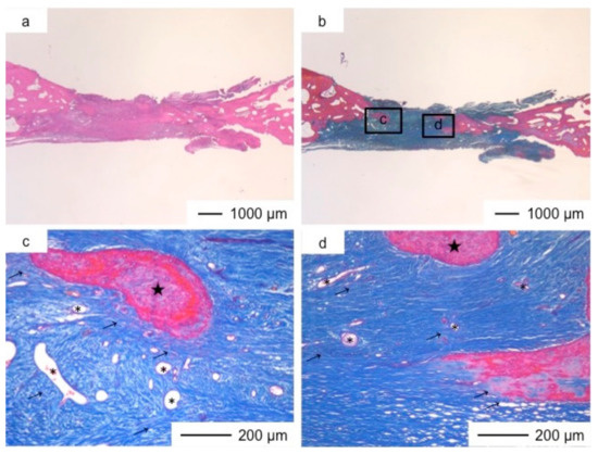 Skull Bone Regeneration Using Chitosan–Siloxane Porous Hybrids—Long ...