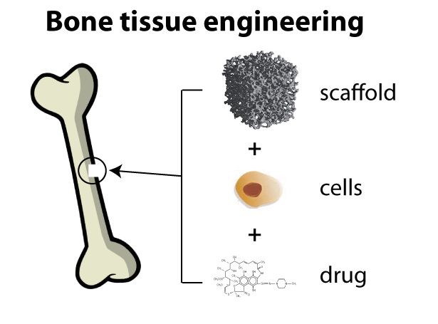 Pharmaceutics | Free Full-Text | Scaffolds as Structural Tools for Bone ...