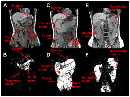 MRI of the Colon in the Pharmaceutical Field: The Future before us
