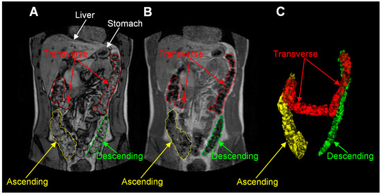 MRI of the Colon in the Pharmaceutical Field: The Future before us