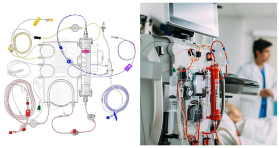 Is Antimicrobial Treatment Effective During Therapeutic Plasma Exchange ...