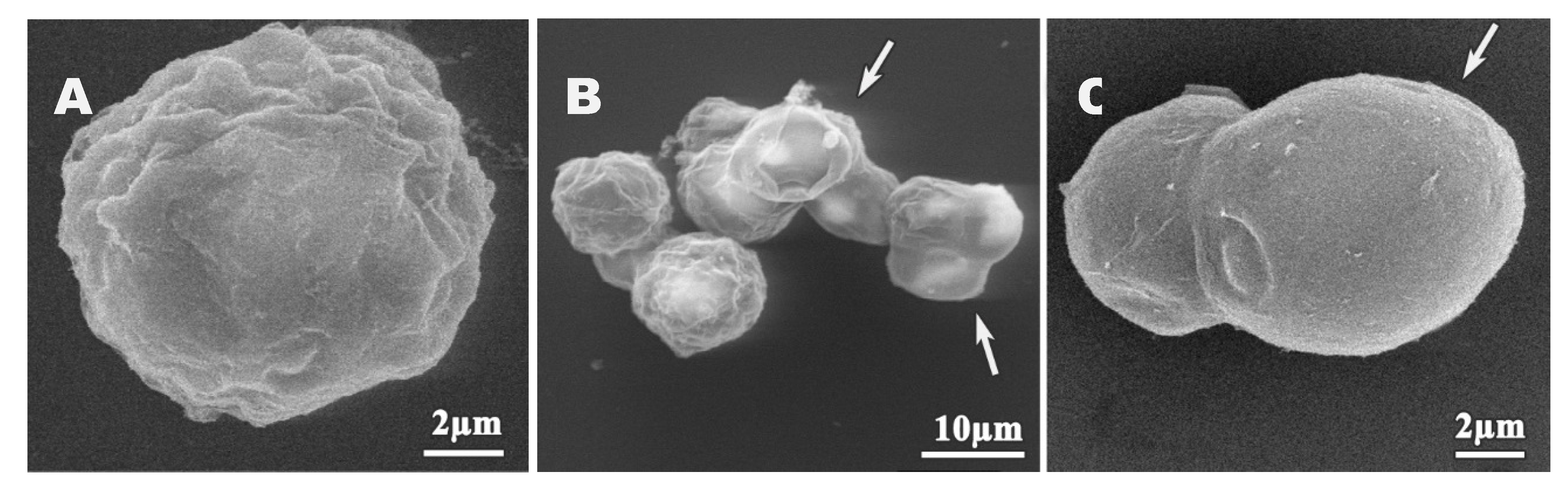 Ultrastructural Study of Acanthamoeba polyphaga Trophozoites and Cysts ...