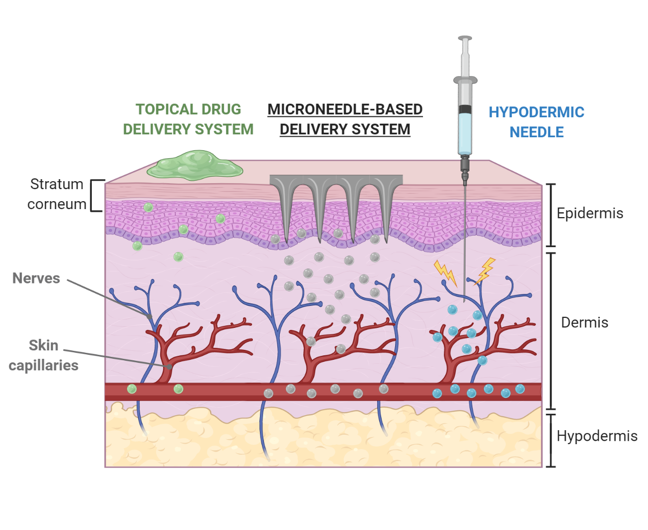 Pharmaceutics | Free Full-Text | Microneedle-Based Delivery: An ...