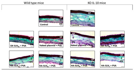 Pharmaceutics | Free Full-Text | Topical Administration of SLN-Based ...
