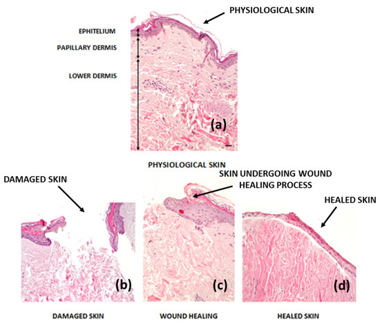 Pharmaceutics | Free Full-Text | Skin Wound Healing Process and New ...