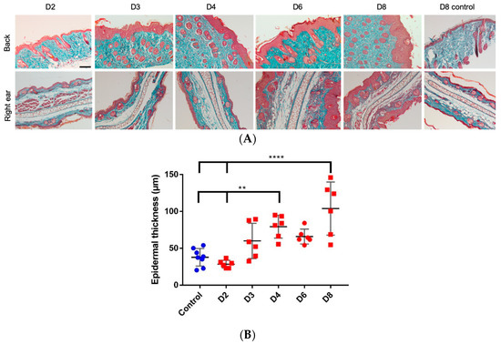 Advanced Characterization of Imiquimod-Induced Psoriasis-Like Mouse Model