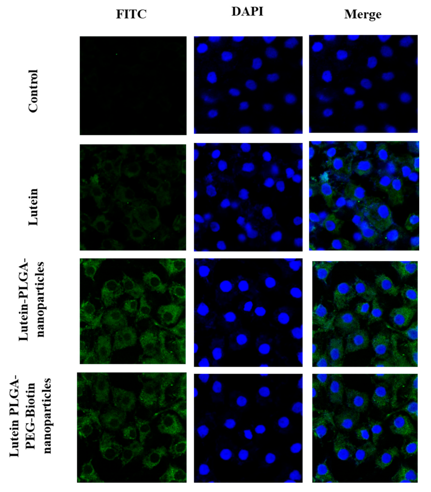 Lutein-Loaded, Biotin-Decorated Polymeric Nanoparticles Enhance Lutein ...