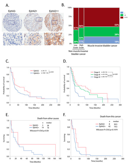Pharmaceutics | Free Full-Text | Targeting EphA2 in Bladder Cancer ...