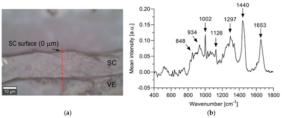 Freezing Weakens the Barrier Function of Reconstructed Human Epidermis ...
