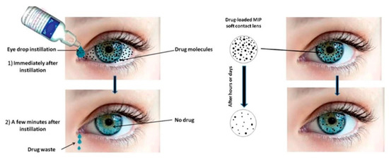 Biodegradable Nanoparticle for Cornea Drug Delivery: Focus Review