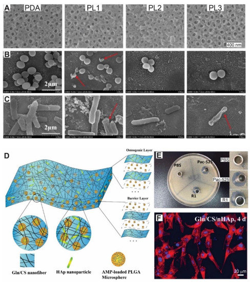 Antibacterial Layer-by-Layer Coatings for Medical Implants