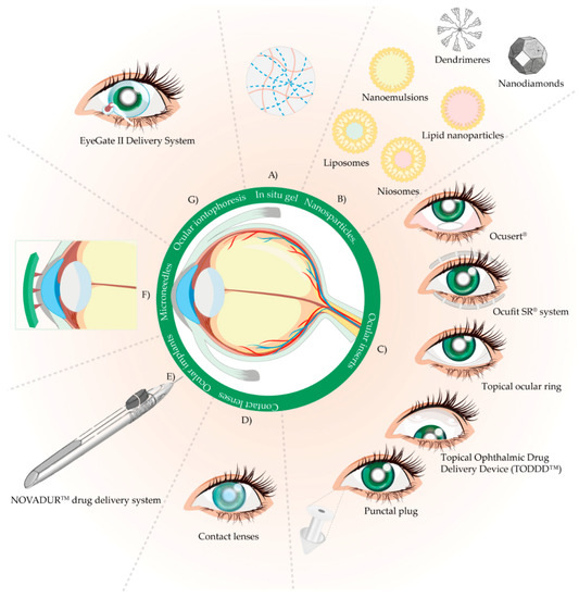 Novel Drug Delivery Systems Fighting Glaucoma: Formulation Obstacles ...