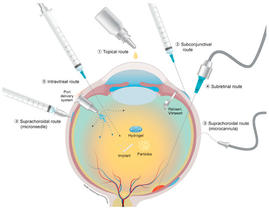 Ocular Drug Delivery to the Retina: Current Innovations and Future ...