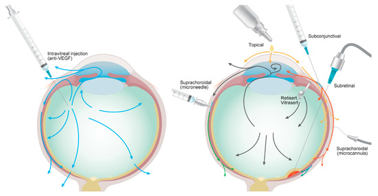 Ocular Drug Delivery to the Retina: Current Innovations and Future ...